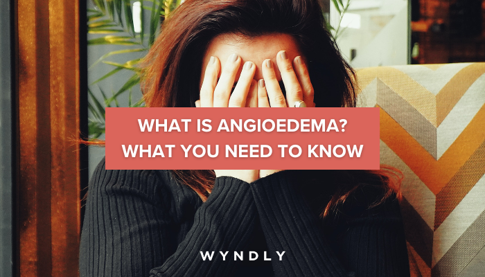 Angioedema: Causes, Symptoms, Types, and Treatment (2024) & Wyndly