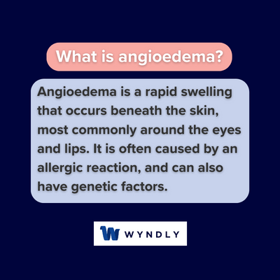 Angioedema Definition: What Is Angioedema? (2024) & Wyndly