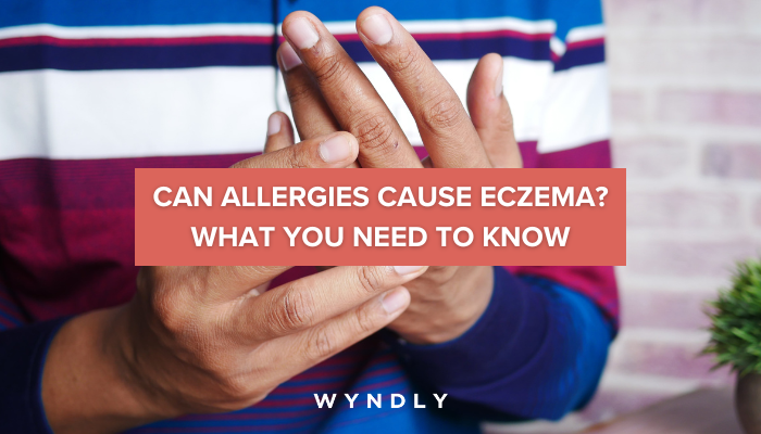 Allergic Eczema: Causes, Symptoms, and Treatment 2025 & Wyndly