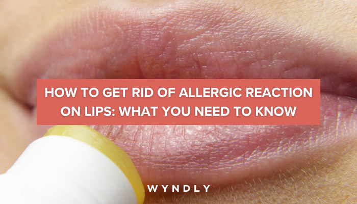 Allergic Reaction on Lips: Causes, Diagnosis, Treatment 2025 & Wyndly
