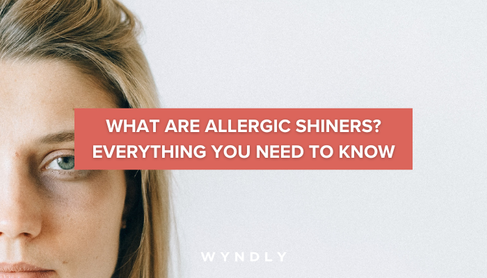 Allergic Shiners: Symptoms, Causes, and Treatment 2025 & Wyndly