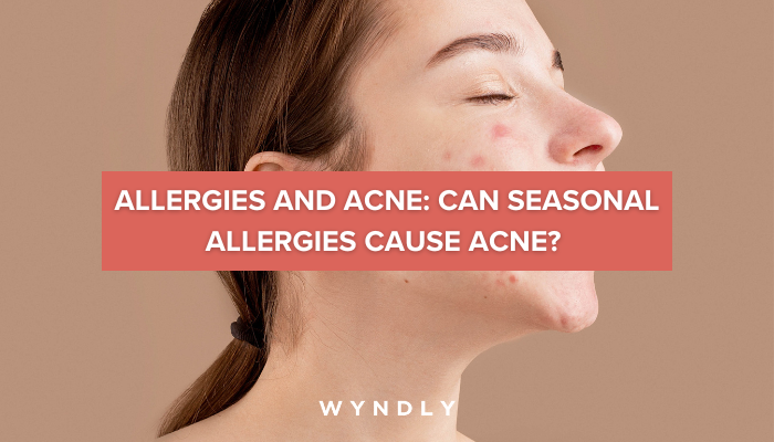 Can Allergies Cause Acne? What You Need to Know 2025 & Wyndly