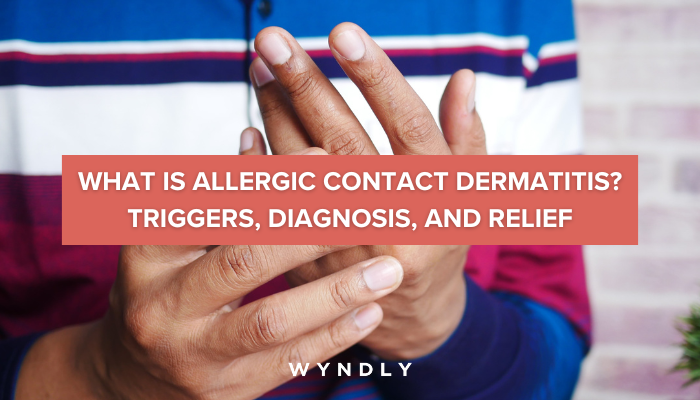 Allergic Contact Dermatitis: Symptoms, Causes, and Treatment 2025 & Wyndly