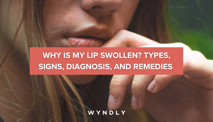 Swollen Lips: Causes, Symptoms, and Treatment 2025 & Wyndly