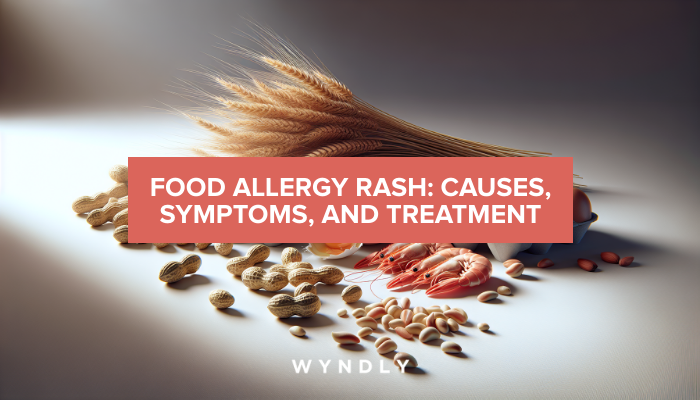 Food Allergy Rash: Causes, Symptoms, and Treatment (2026) & Wyndly